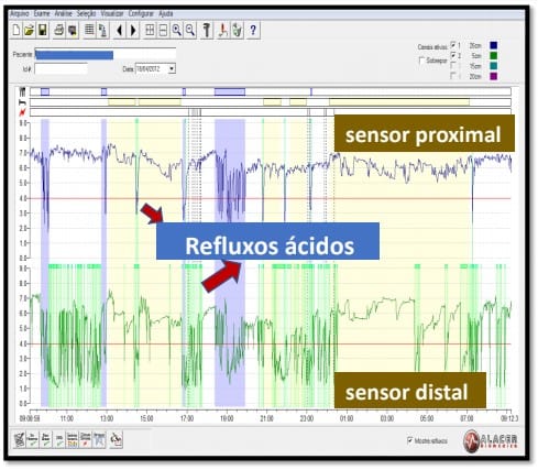 Phmetria Esofágica Computadorizada 24hs – CEFIDI